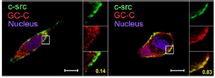 Receptor guanylyl cyclase C
